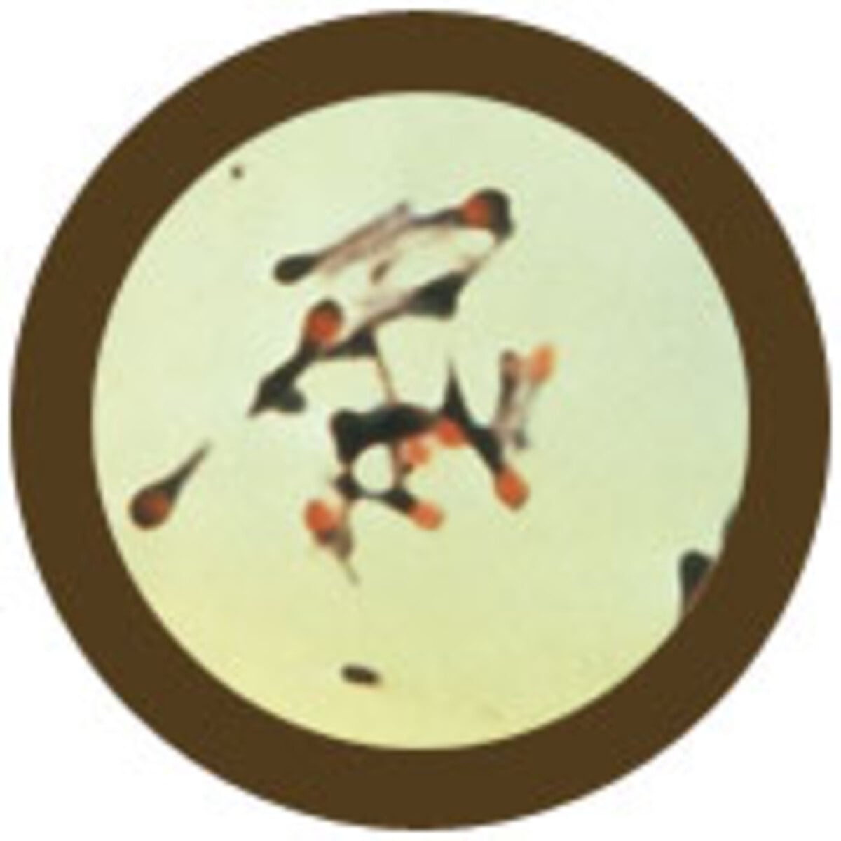 Tetanus (Clostridium tetani)