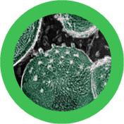 Chlamydia (Chlamydia trachomatis)