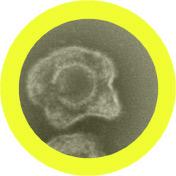 Herpes (Herpes Simplex Virus 2)