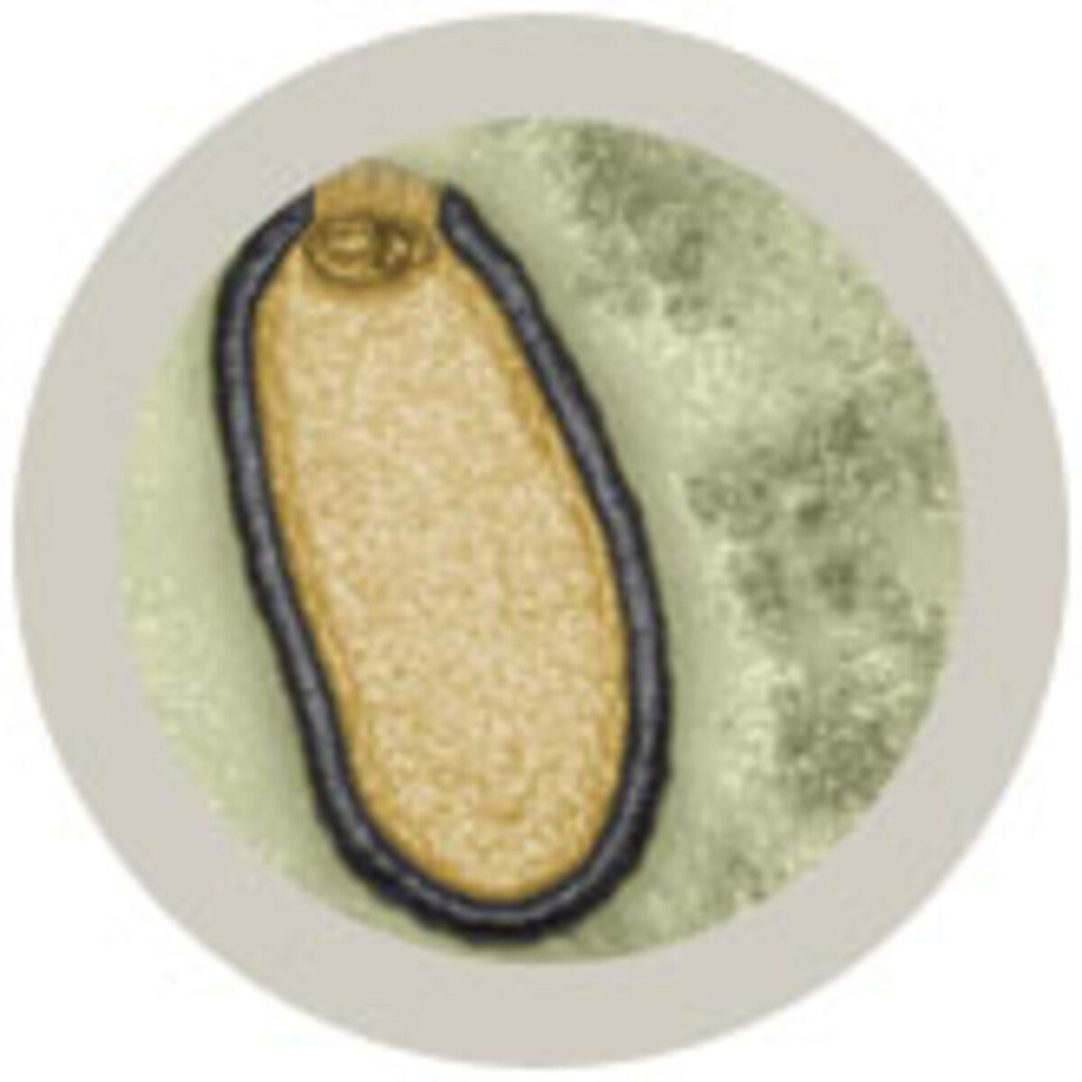 Zombie Virus (Pithovirus sibericum)