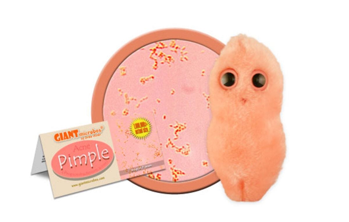 giant pimple