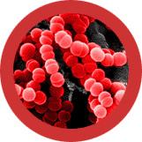 Sore Throat (Streptococcus)