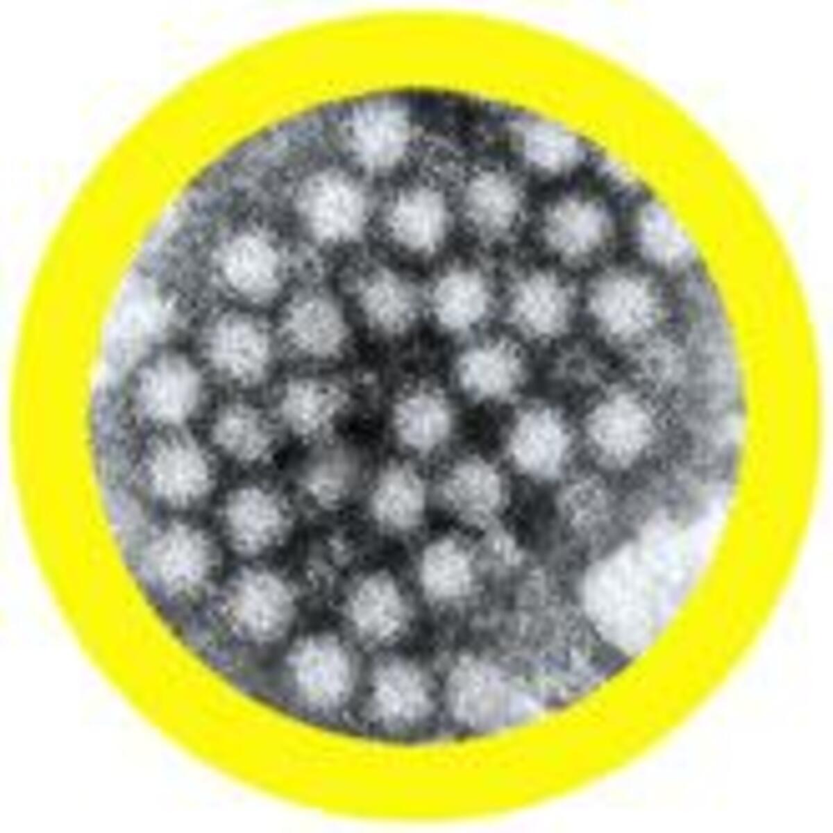 Norovirus (Norovirus)