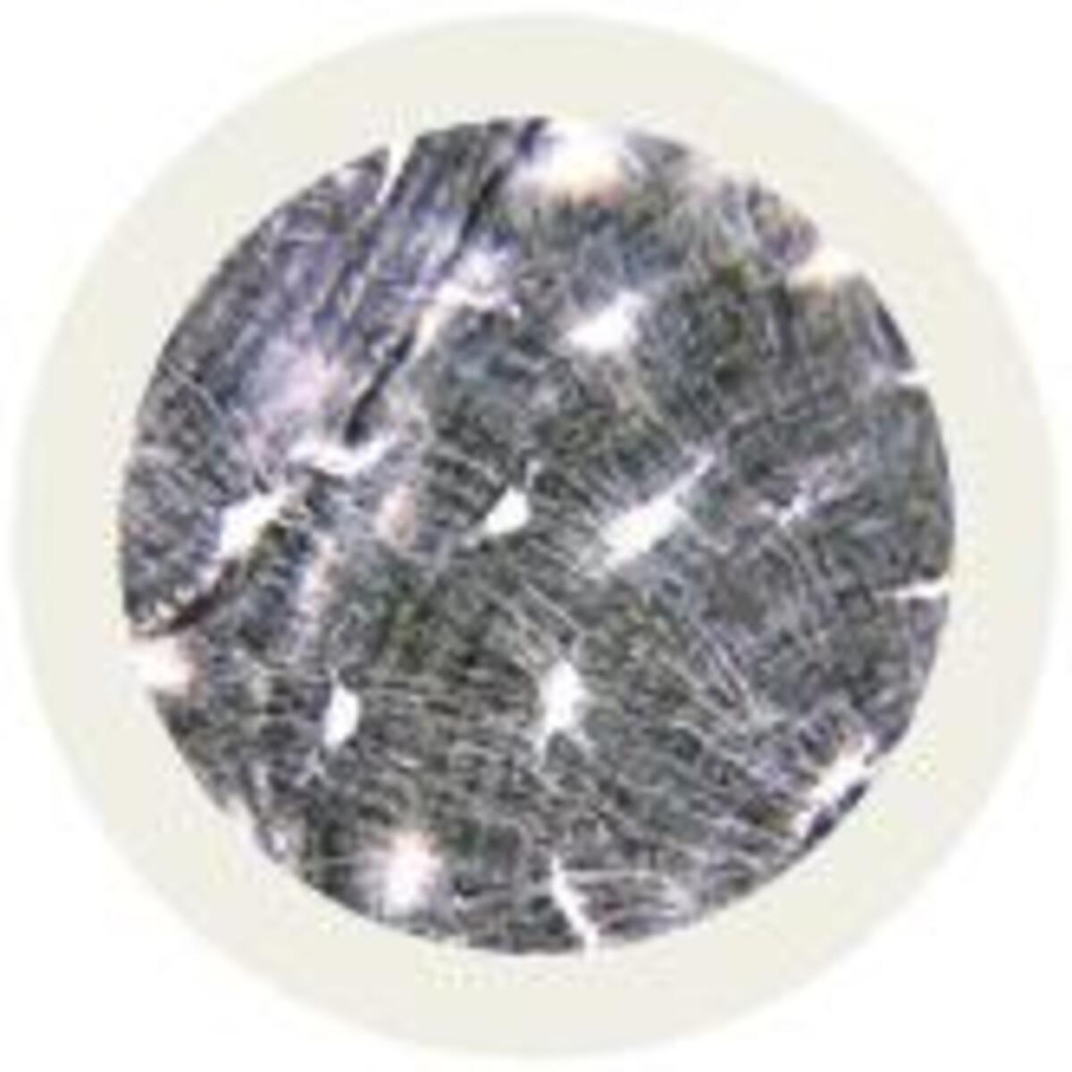 Bone Cell (Osteocyte)